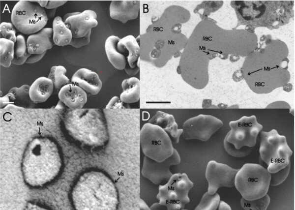 에페리트로쥰 감염증과 마이코플라스마 수이스 감염증